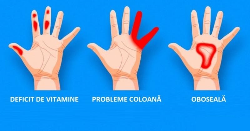 5 lucruri pe care mâinile ți le dezvăluie despre problemele de sănătate